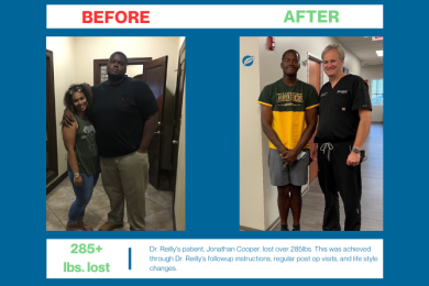 A Weight Loss Success Story: Dr. Reilly's Expertise in Laparoscopic ...